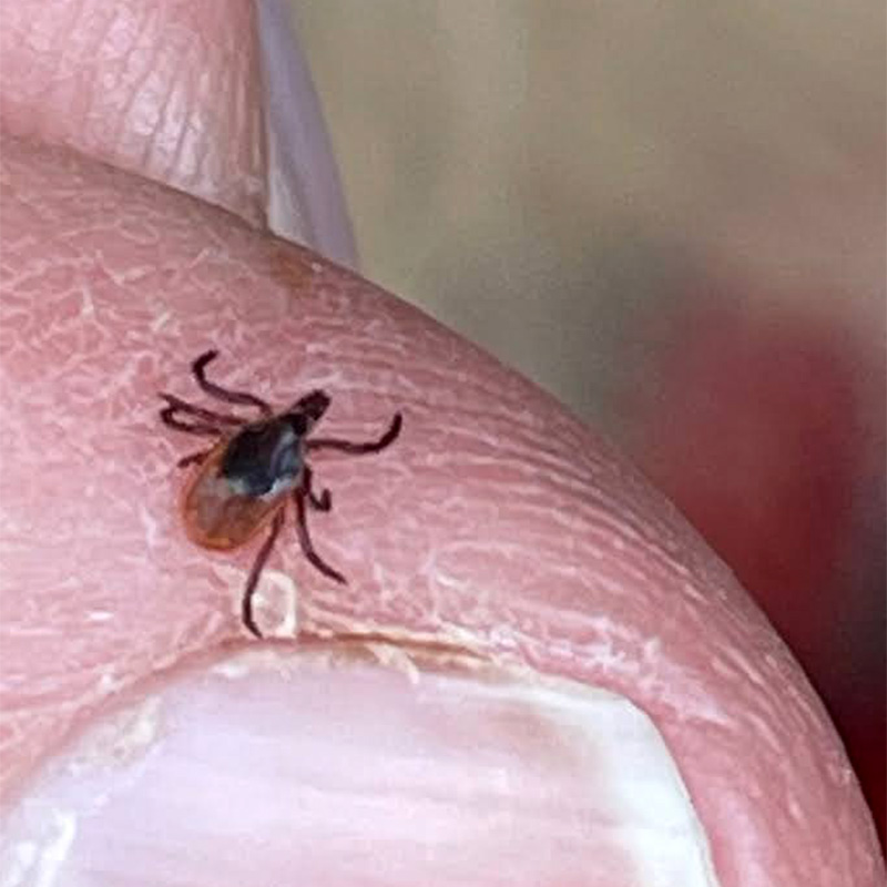 The black-legged tick we hate and fear has a trick that could heal ...